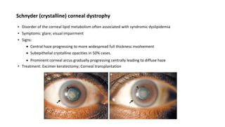 Corneal Dystrophy | PPTX