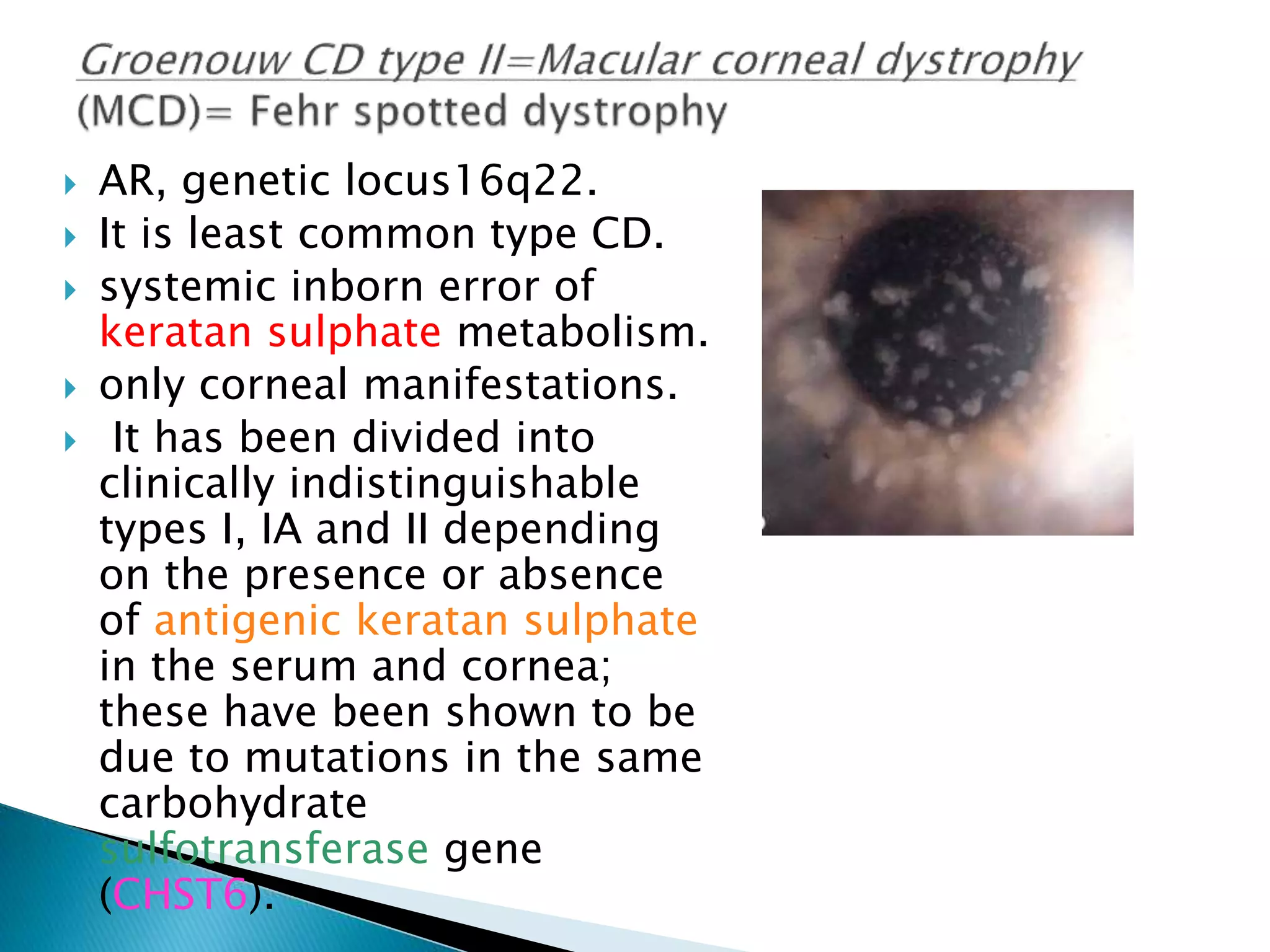 corneal dystrophy.pptx