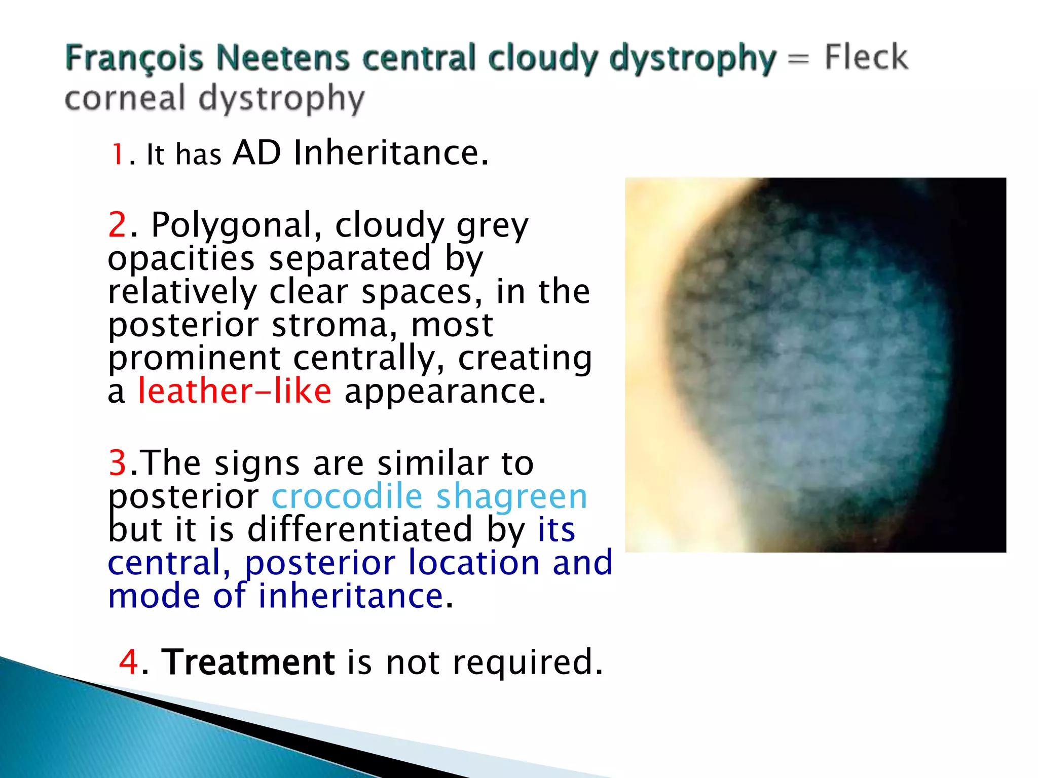 corneal dystrophy.pptx