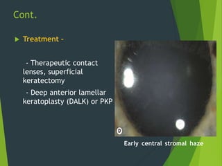 Corneal dystrophy by_dr.adnan | PPT