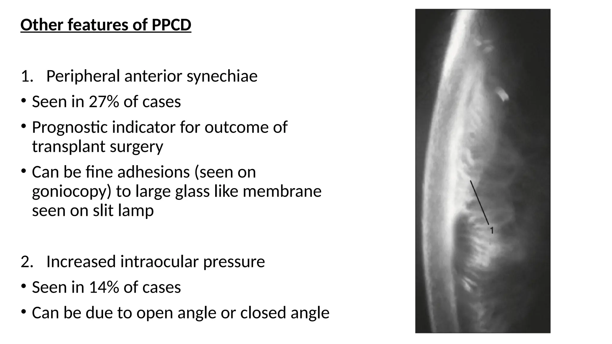 CORNEAL DYSTROPHY, DEGENERATION and treatment | PPTX
