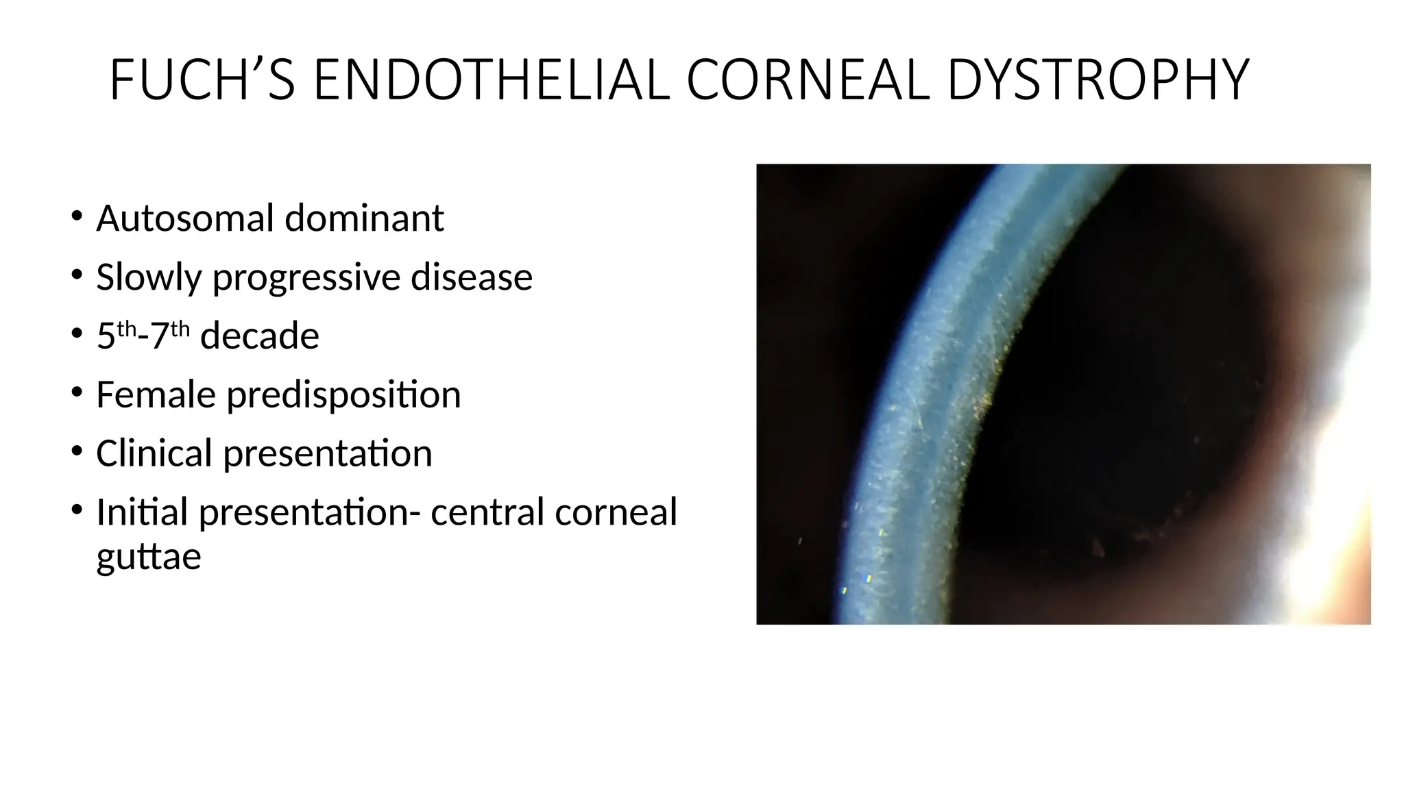 CORNEAL DYSTROPHY, DEGENERATION and treatment | PPTX