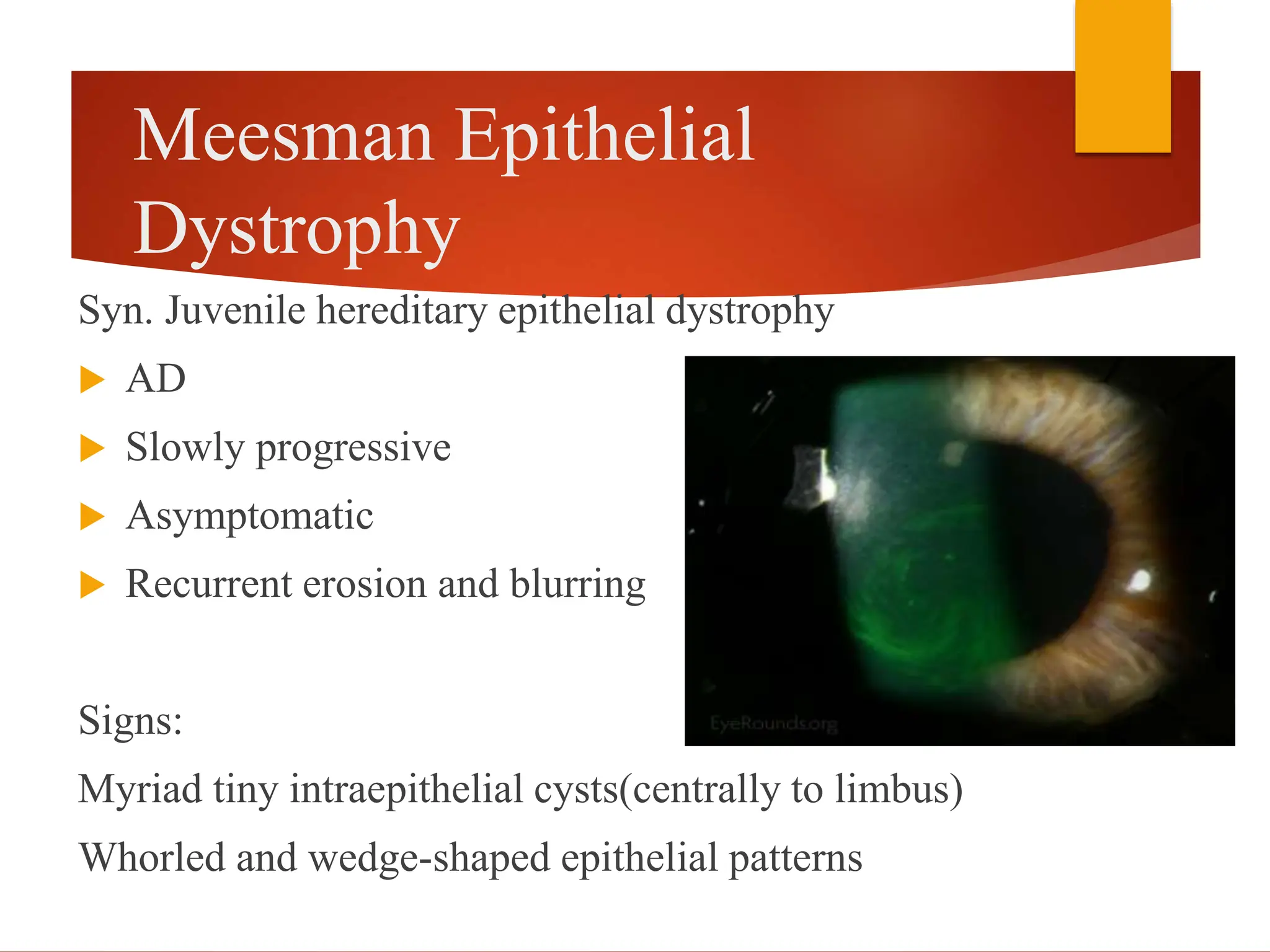 corneal dystrophy and corneal disorders (1).pptx