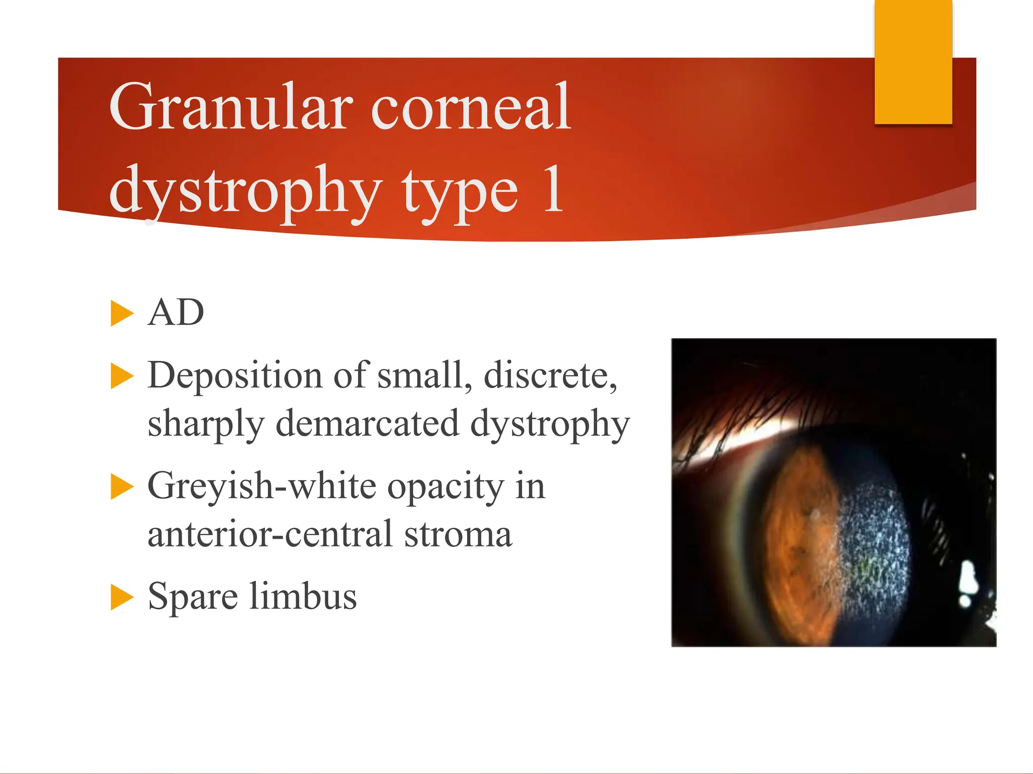 corneal dystrophy and corneal disorders (1).pptx