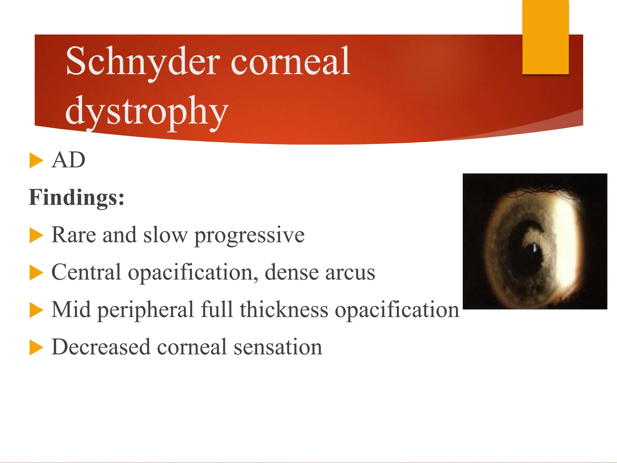 corneal dystrophy and corneal disorders (1).pptx