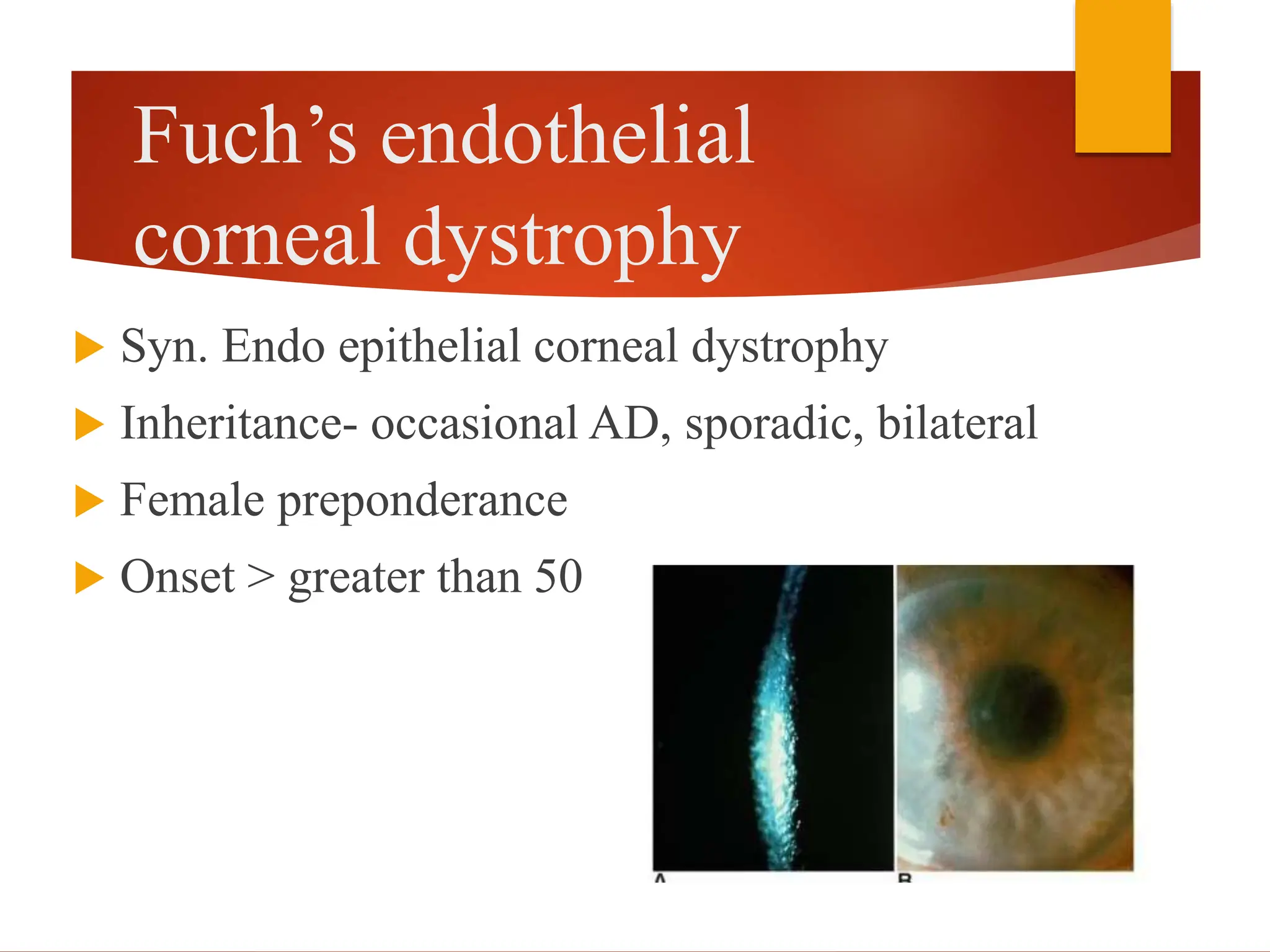 corneal dystrophy and corneal disorders (1).pptx
