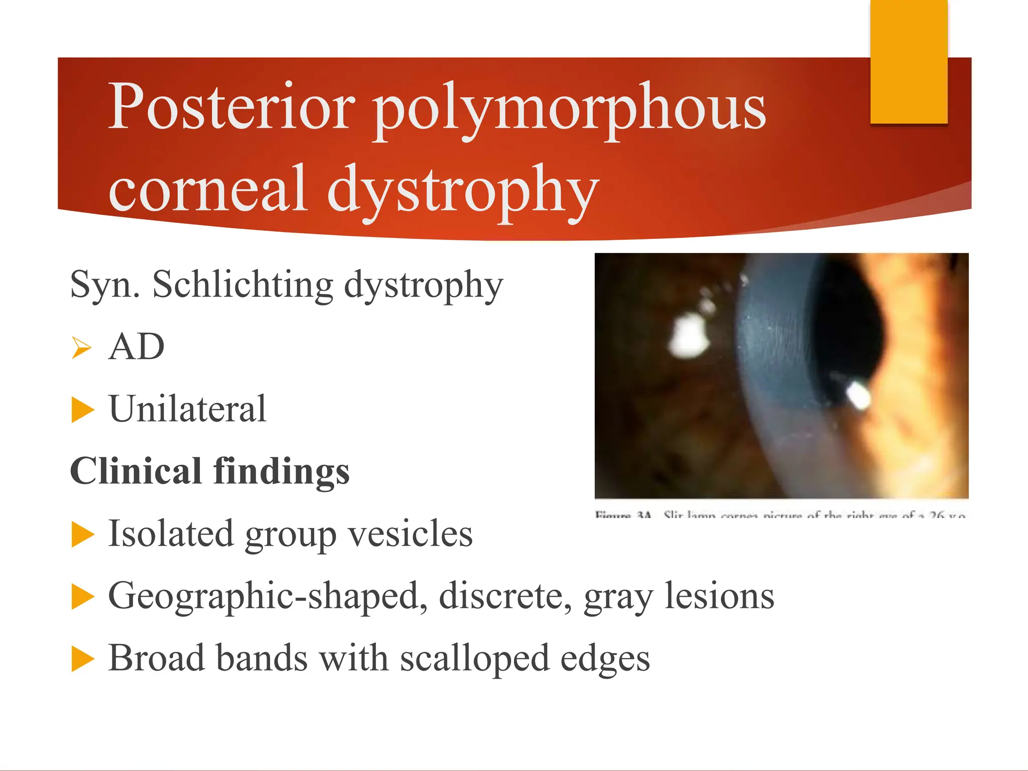 corneal dystrophy and corneal disorders (1).pptx
