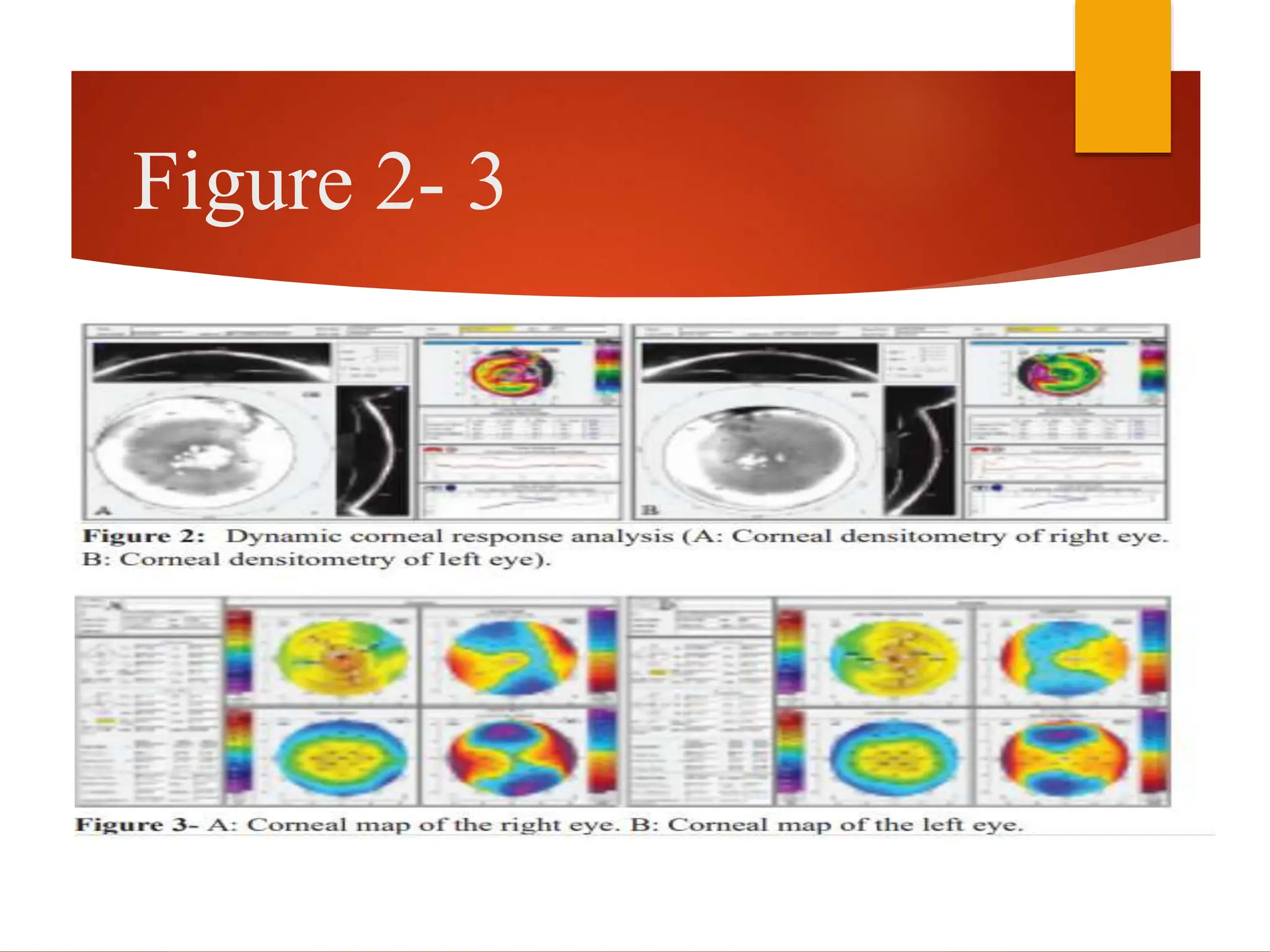 corneal dystrophy and corneal disorders (1).pptx