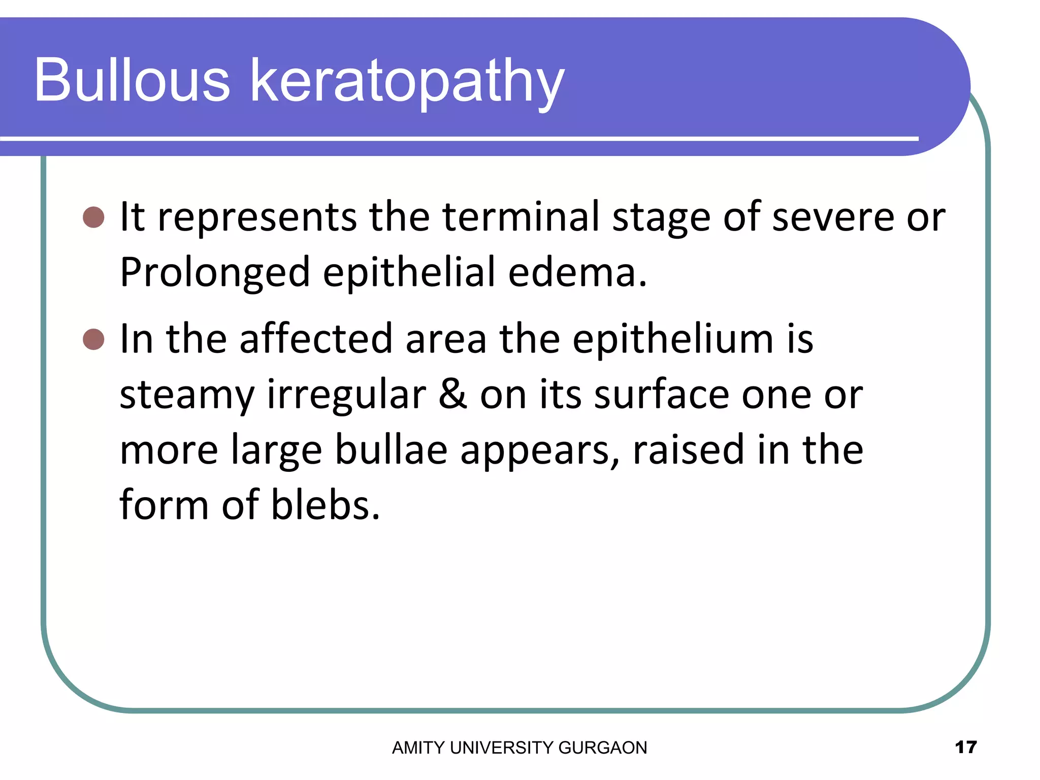 Corneal edema | PPTX
