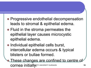 Corneal edema | PPTX | Eye and Vision Conditions | Diseases and Conditions