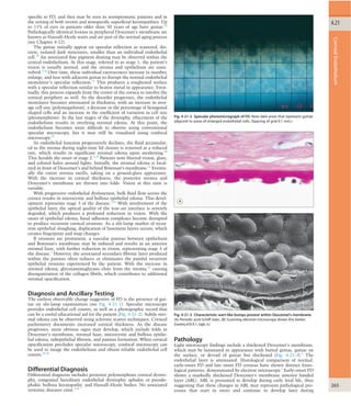 Corneal endothelium | PDF