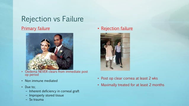 Corneal graft rejection | PPTX