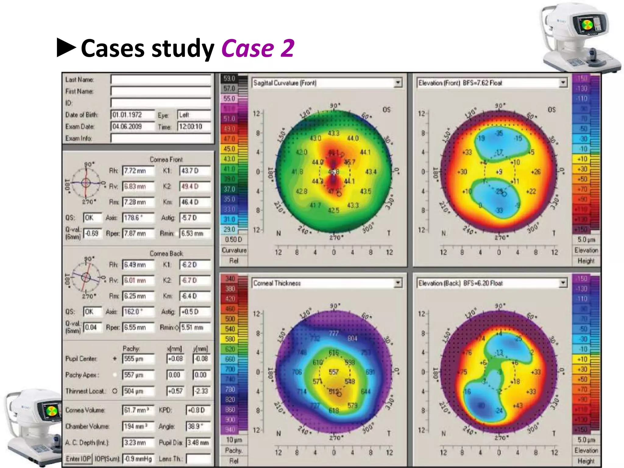 Corneal imaging for undergraduate | PPTX