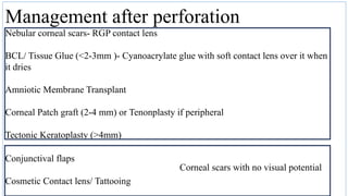 Corneal Keratitis- Infectious Keratitis and Mooren's Ulcer- Clinical ...