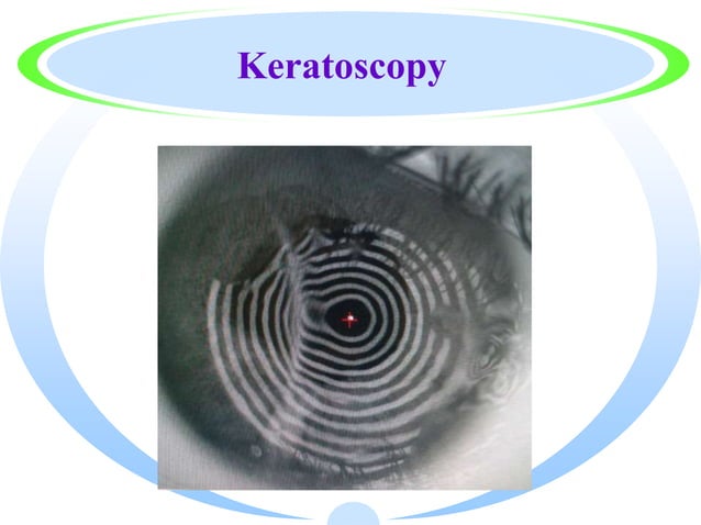 Corneal laceration repair tips | PPT | Eye and Vision Conditions ...