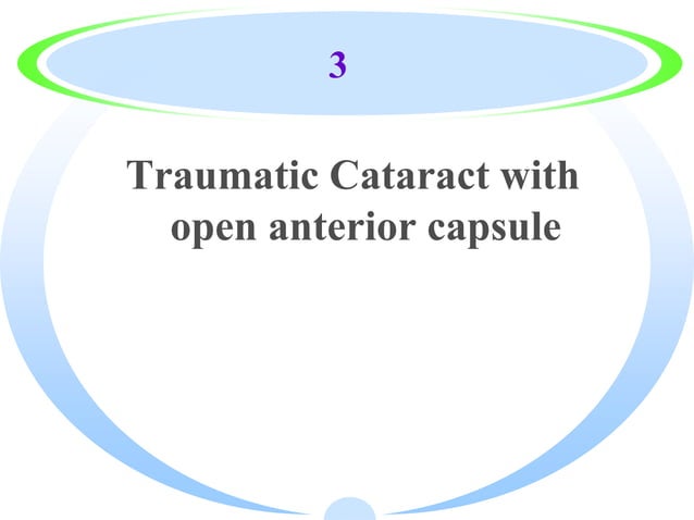 Corneal laceration repair tips | PPT | Eye and Vision Conditions ...