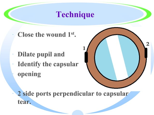 Corneal laceration repair tips | PPT | Eye and Vision Conditions ...