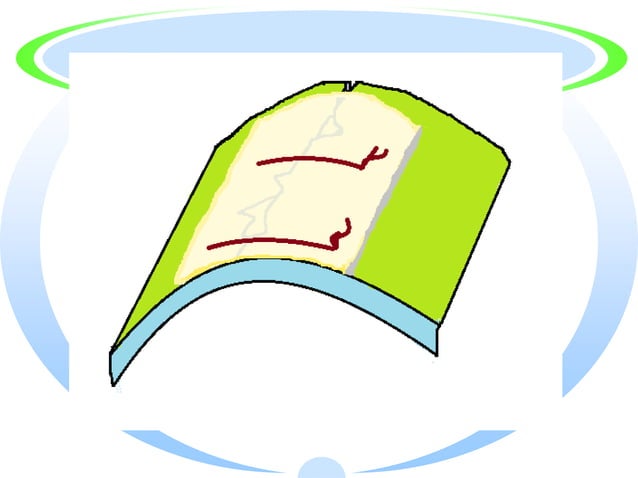 Corneal laceration repair tips | PPT | Eye and Vision Conditions ...