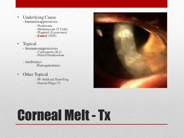 Corneal Melt