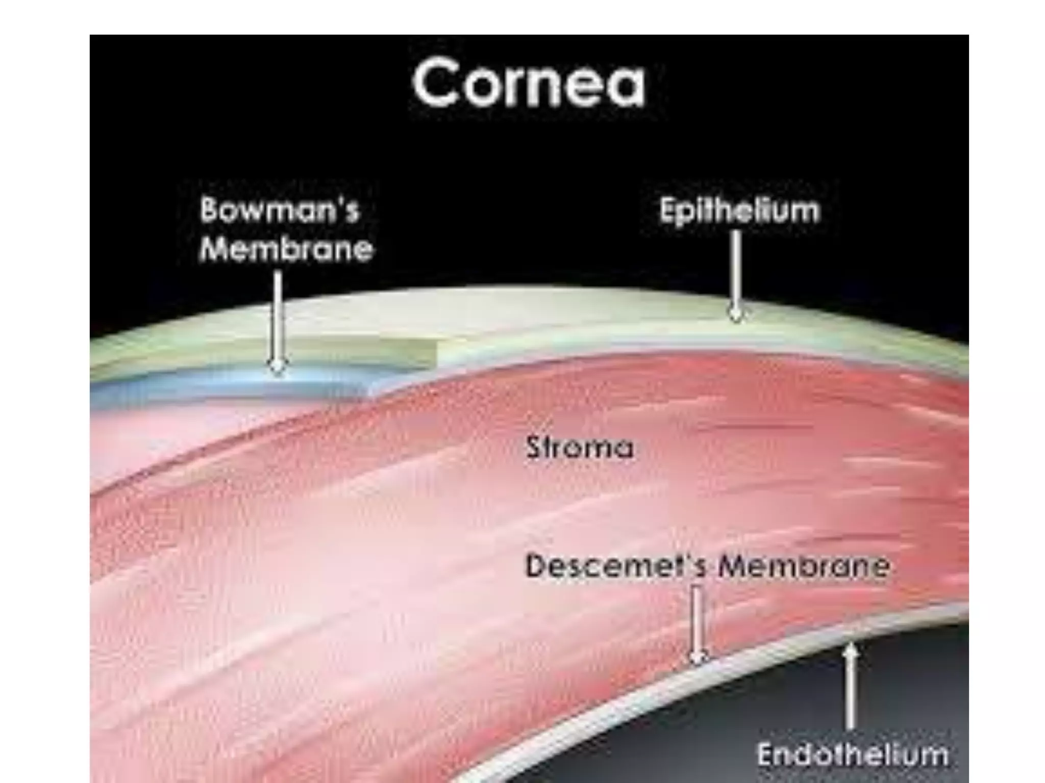 Corneal neovascularization | PPTX