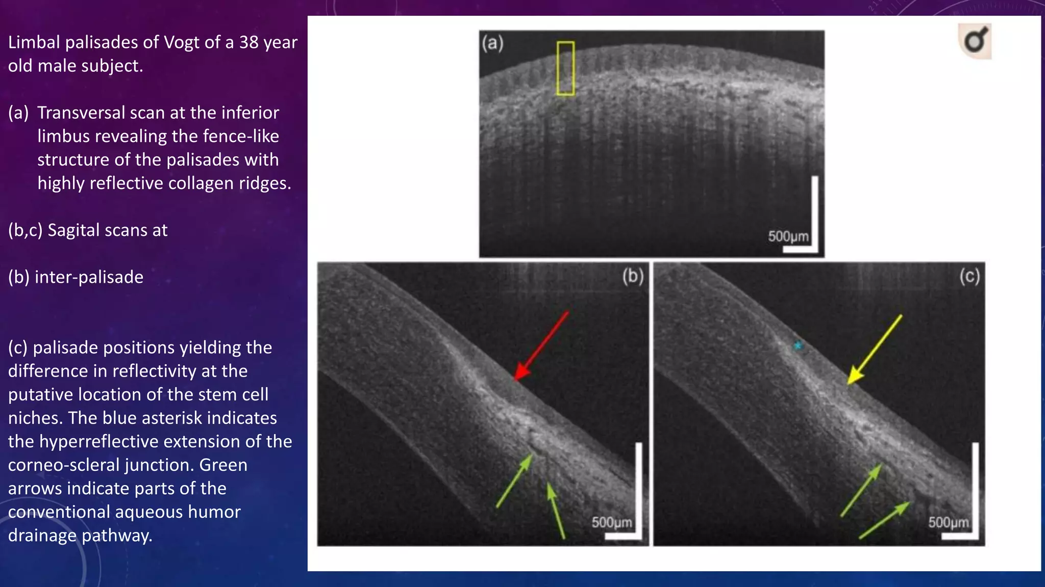 Anterior segment and Corneal OCT review | PPSX