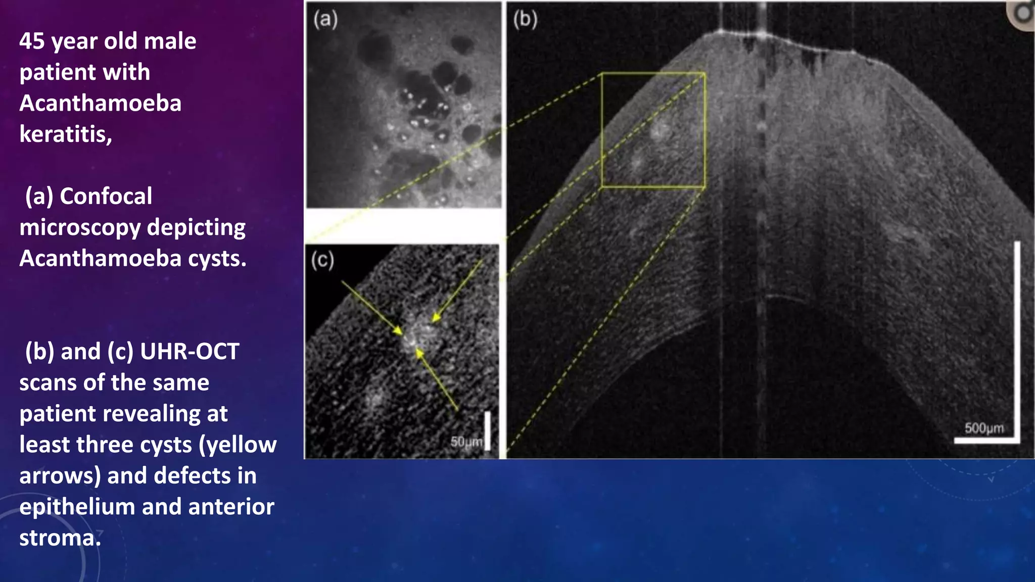 Anterior segment and Corneal OCT review | PPSX