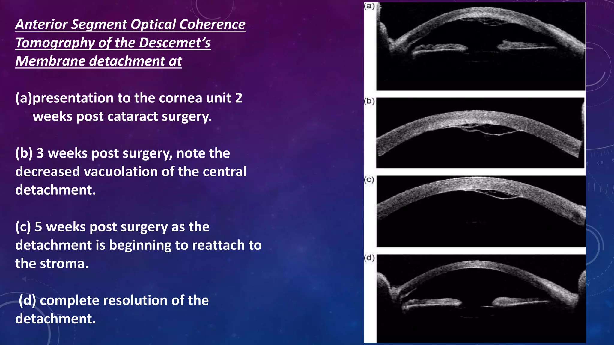 Anterior segment and Corneal OCT review | PPSX