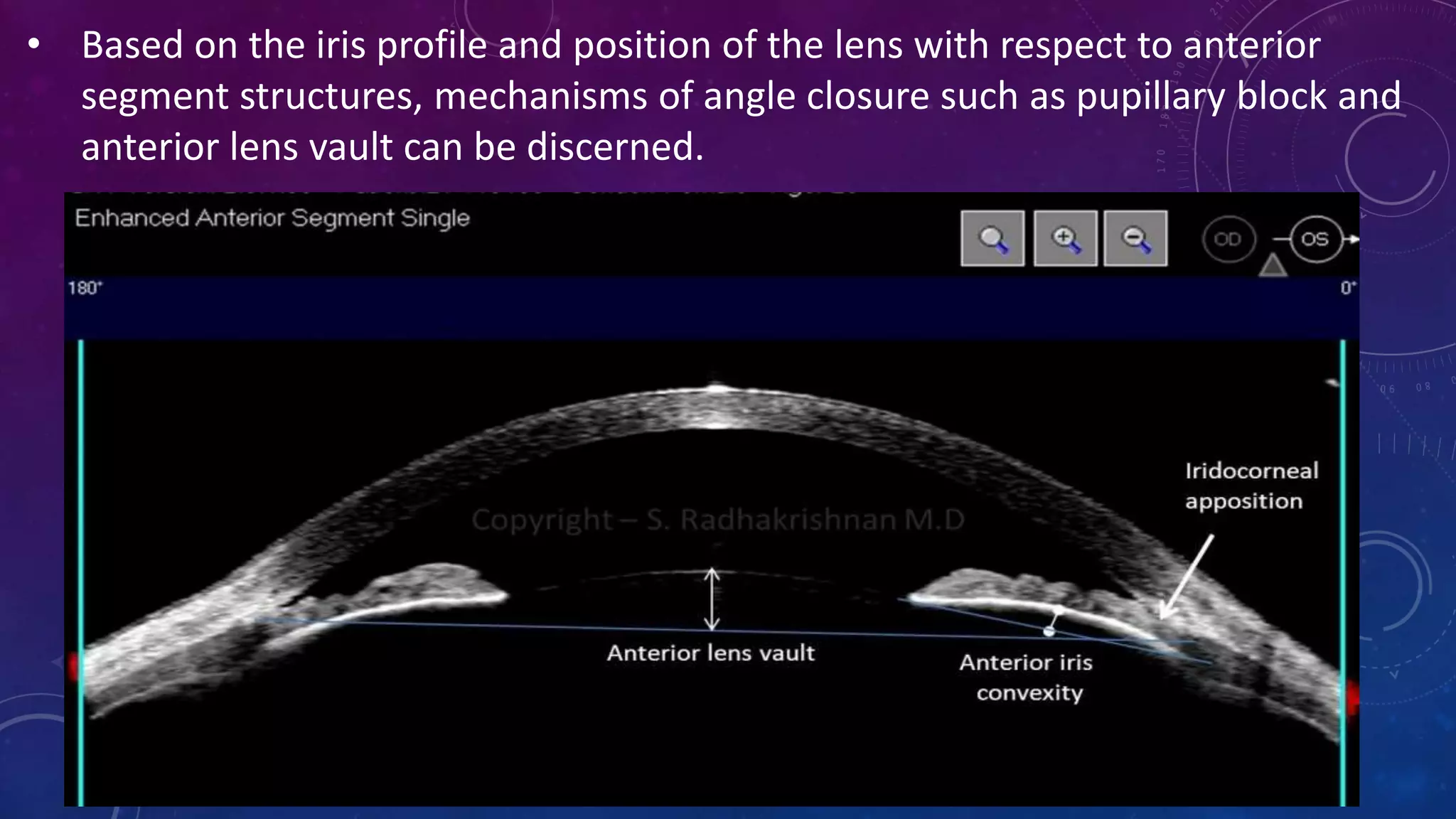 Anterior segment and Corneal OCT review | PPSX