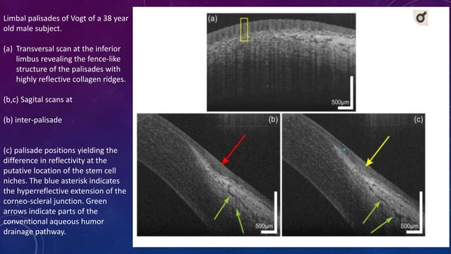 Anterior segment and Corneal OCT review | PPSX