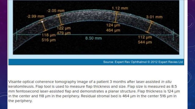 Anterior segment and Corneal OCT review | PPSX