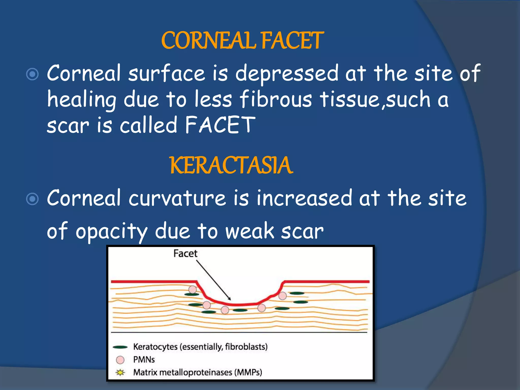 Corneal opacity | PPTX