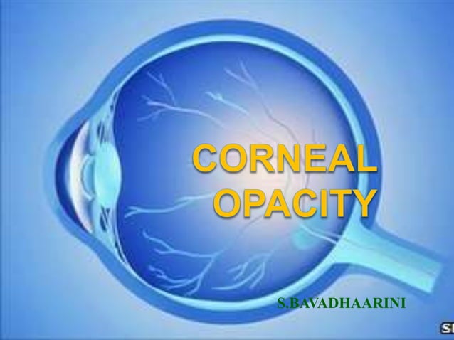 Corneal opacity | PPTX | Eye and Vision Conditions | Diseases and ...