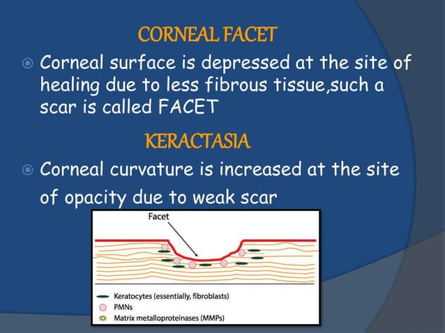Corneal opacity | PPT