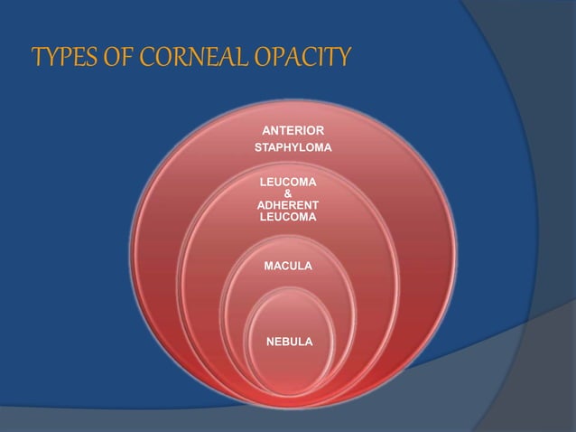 Corneal opacity | PPTX | Eye and Vision Conditions | Diseases and ...