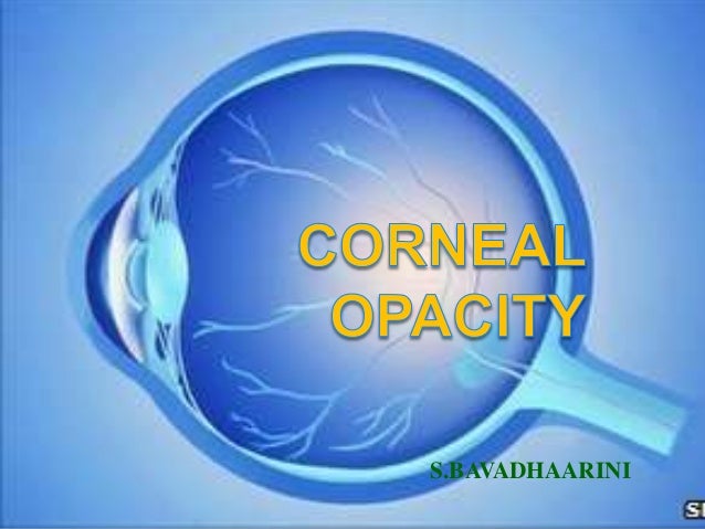 Corneal opacity
