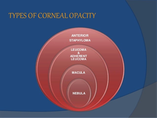 Corneal opacity