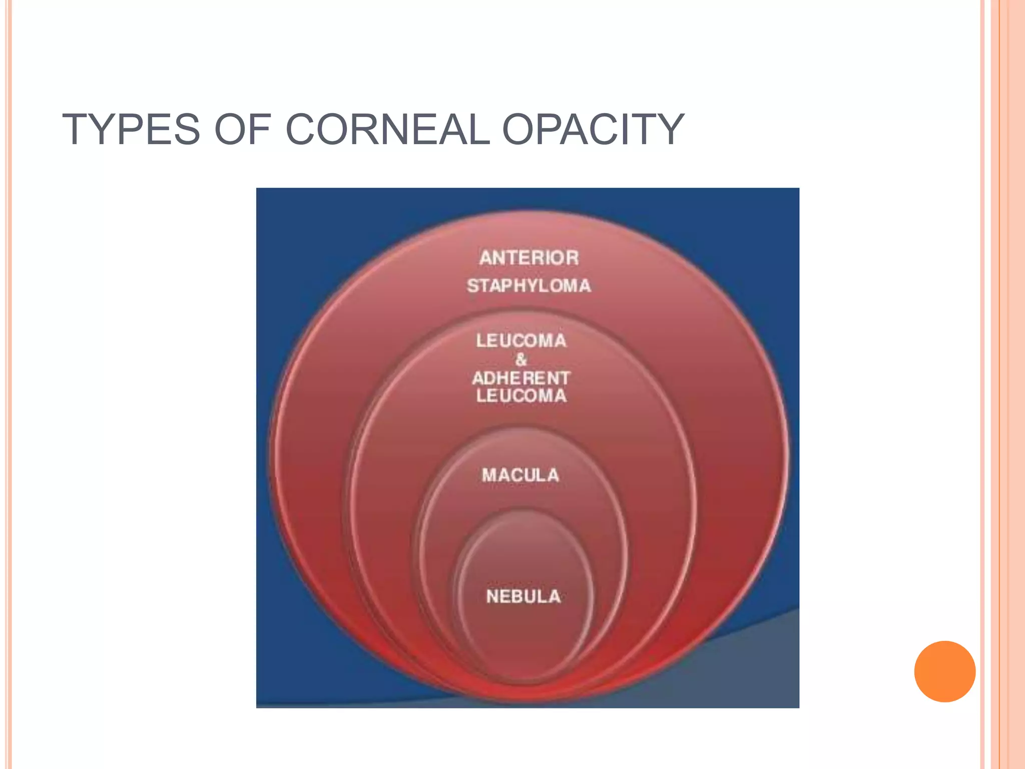 Corneal opacity | PPTX