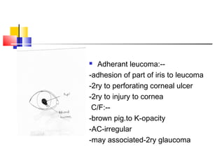 Corneal opacity | PPT