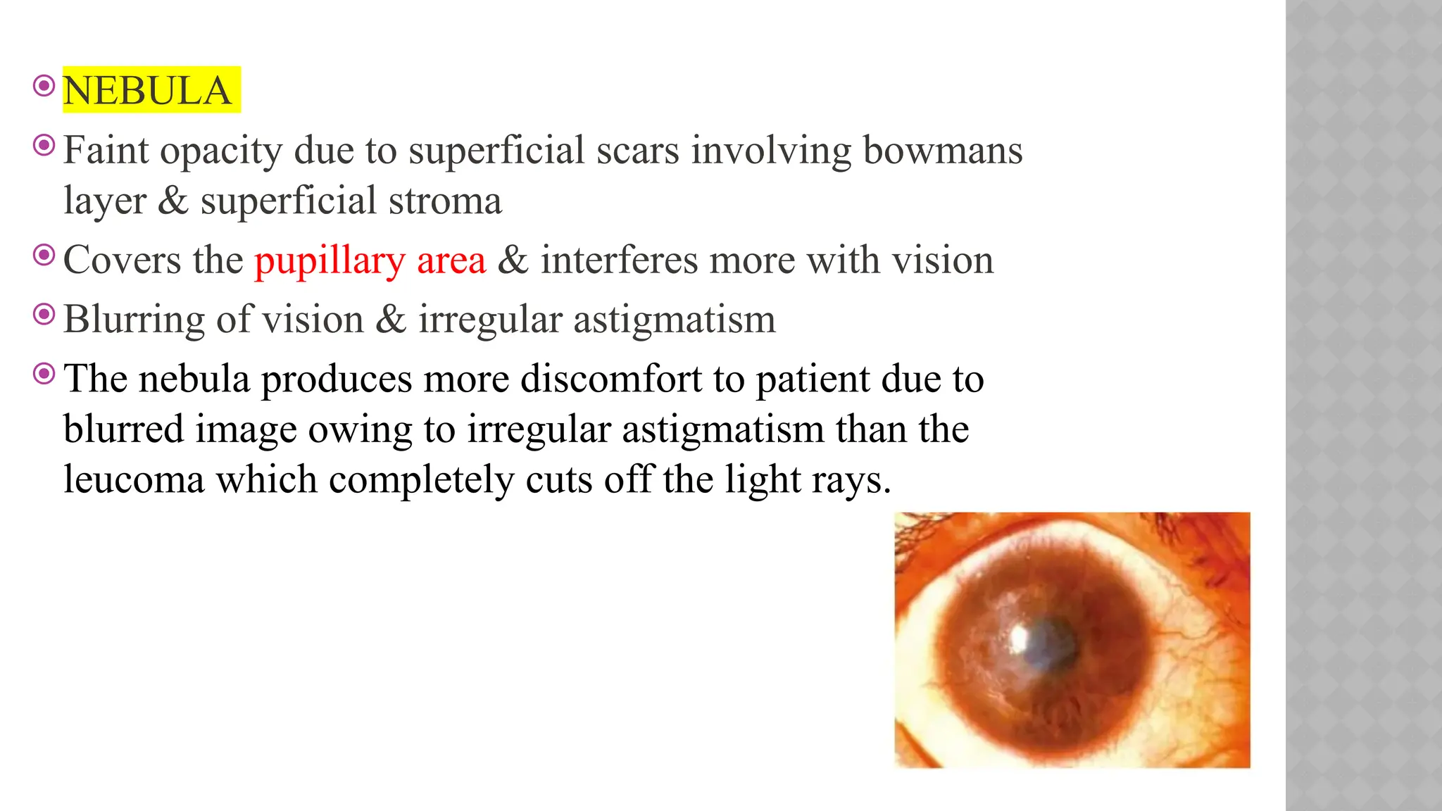 CORNEAL OPACITY.pptx,corneal opacity, types/grades. clinical features ...