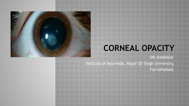 CORNEAL OPACITY.pptx,corneal opacity, types/grades. clinical features ...