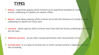CORNEAL OPACITY hpfrom doctors pptx.pptx