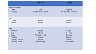 Corneal Opacity case | PPTX