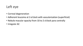 Corneal Opacity case | PPTX
