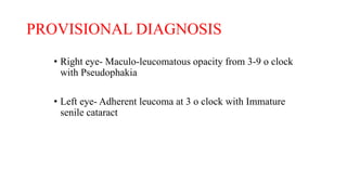 Corneal Opacity case | PPTX