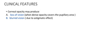 Corneal opacity 2.pptx