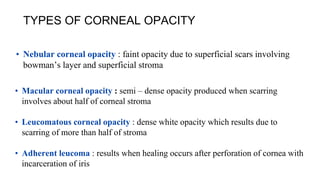 Corneal opacity 2.pptx