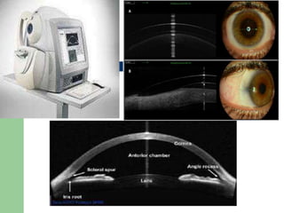 Corneal pachymetry.ppt