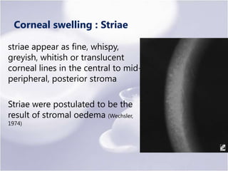 Corneal physiology in relation to contact lens wear | PPT