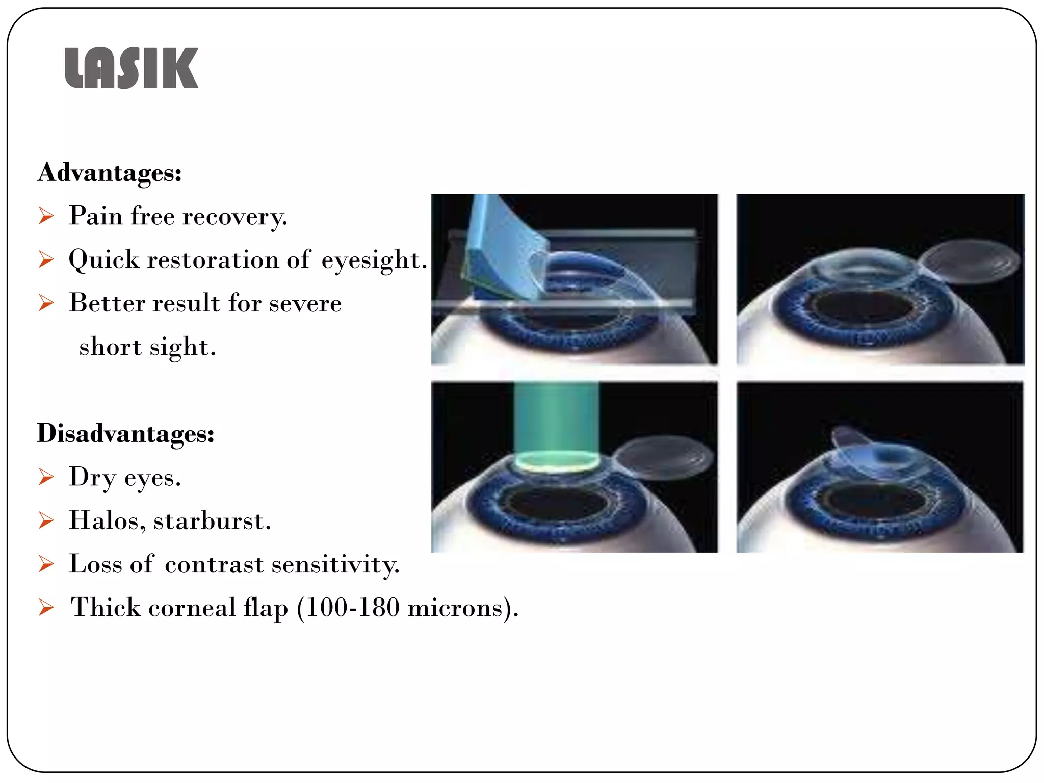 Corneal refractive surgery | PPTX