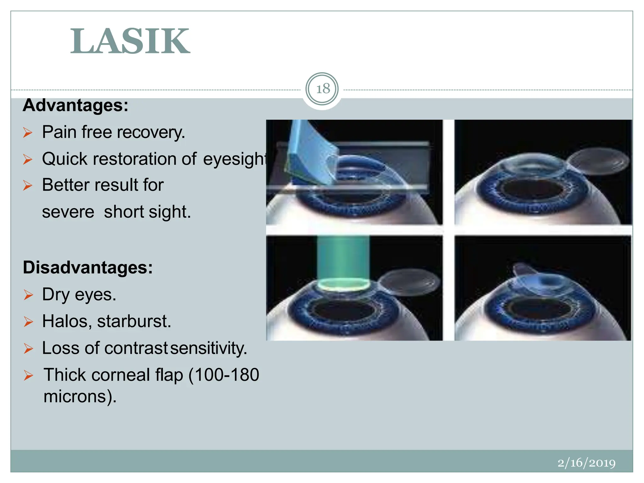 cornealrefractivesurgery-190216085714.pdf